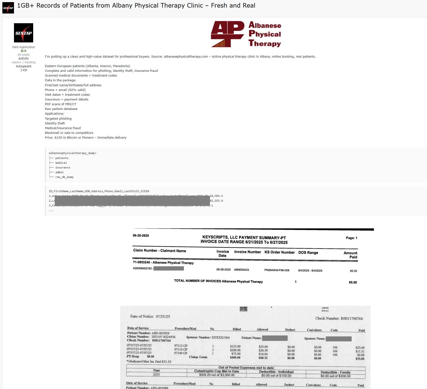 Albanese Physical Therapy Data Breach Exposes Patient Records - Daily ...